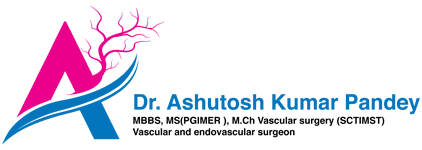 Vascular Loop: Anatomy, Symptoms, Diagnosis & Treatment Guide